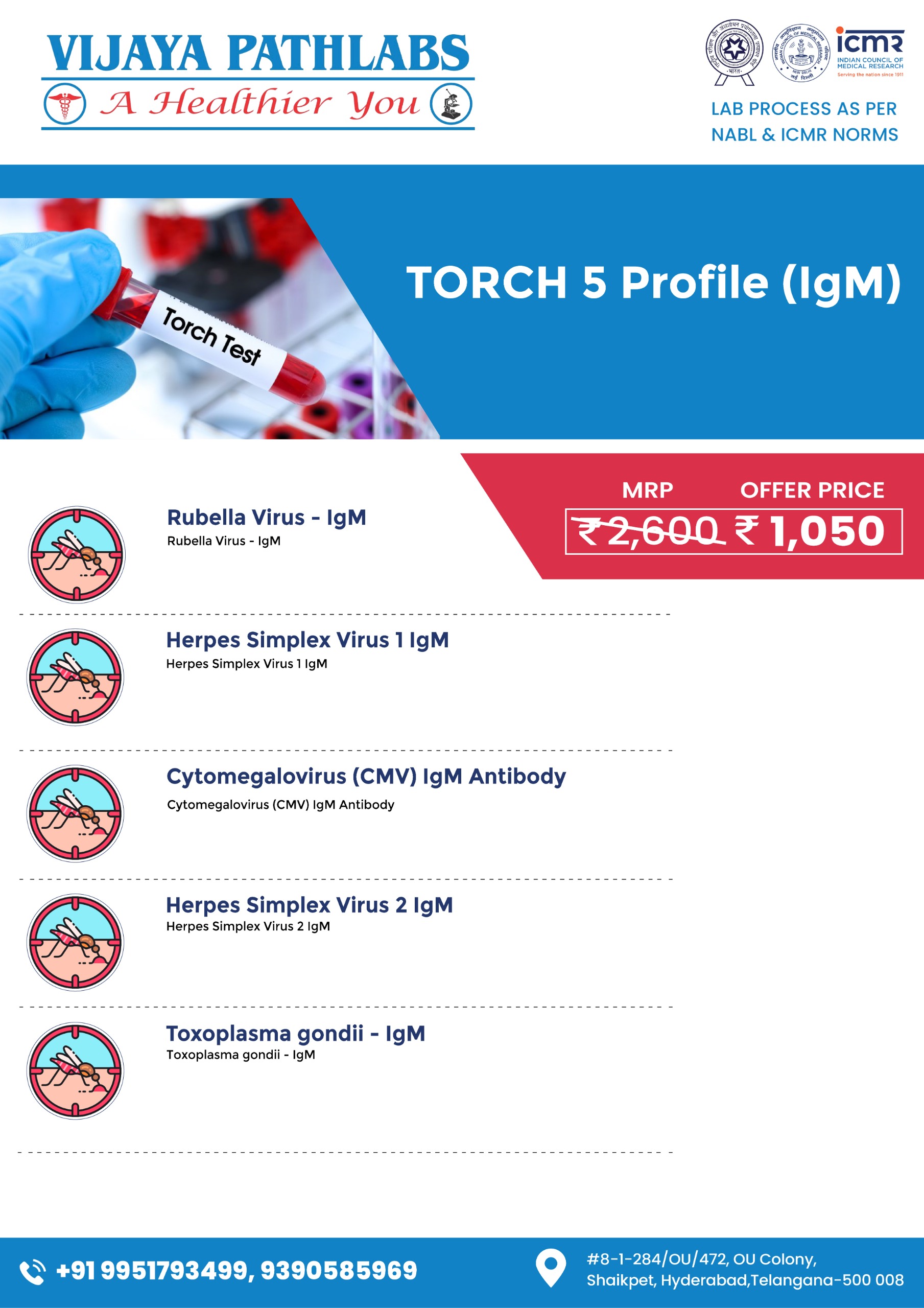 TORCH 5 Profile (IgM) – Vijaya Pathlabs